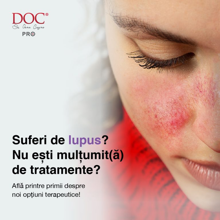 Urmatoarele Studii despre Lupus - DOC PRO - specialists in clinical research patient recruitment